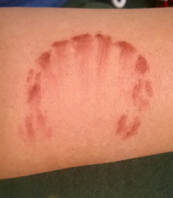 Special FX Focus - Scarring usign Rigid Collodion